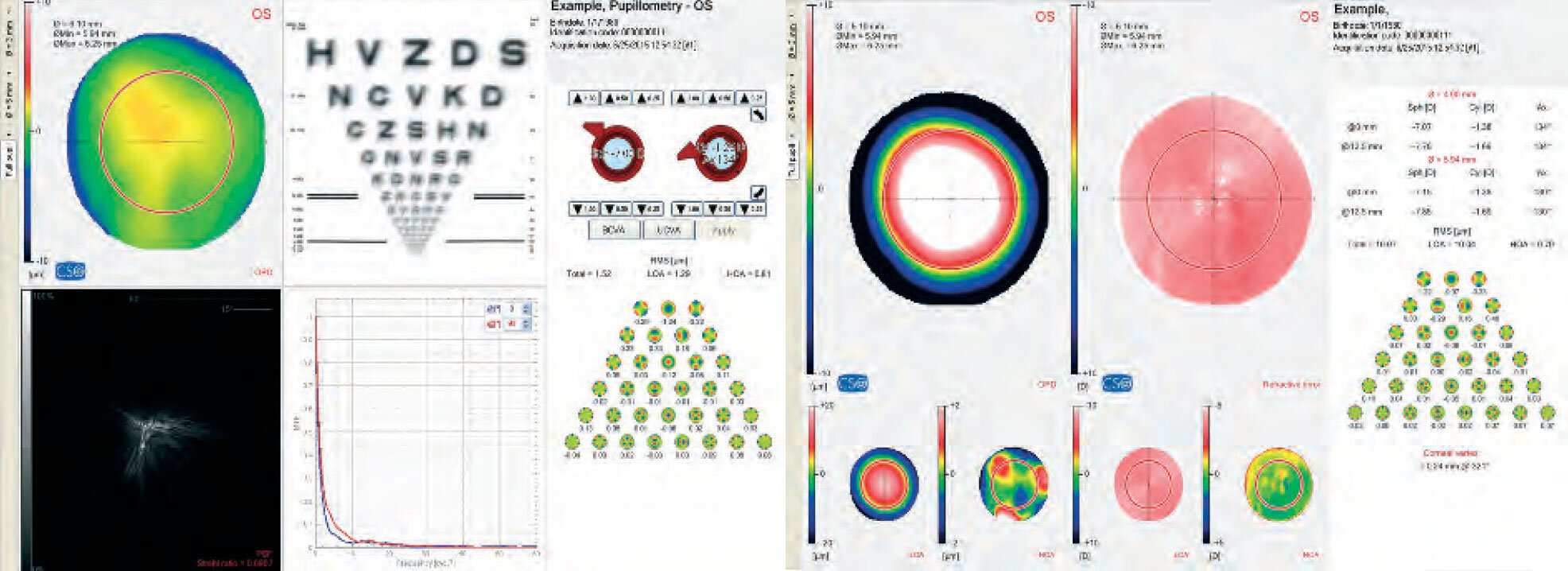 SCHWIND PERAMIS: Topograph und Aberrometer - Schwind